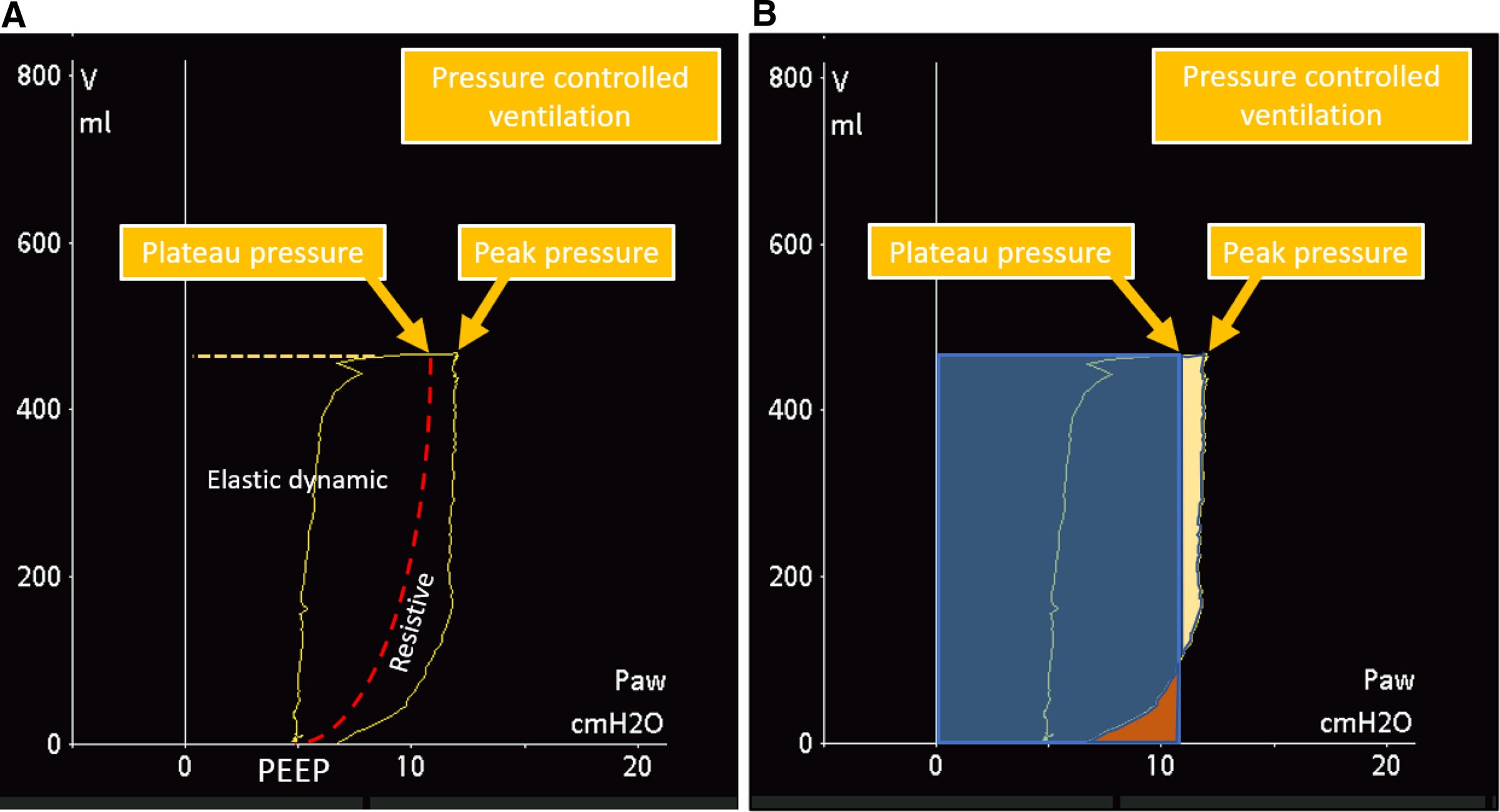 Mechanical Power in Pressure-Controlled Ventilation: A Simple and ...