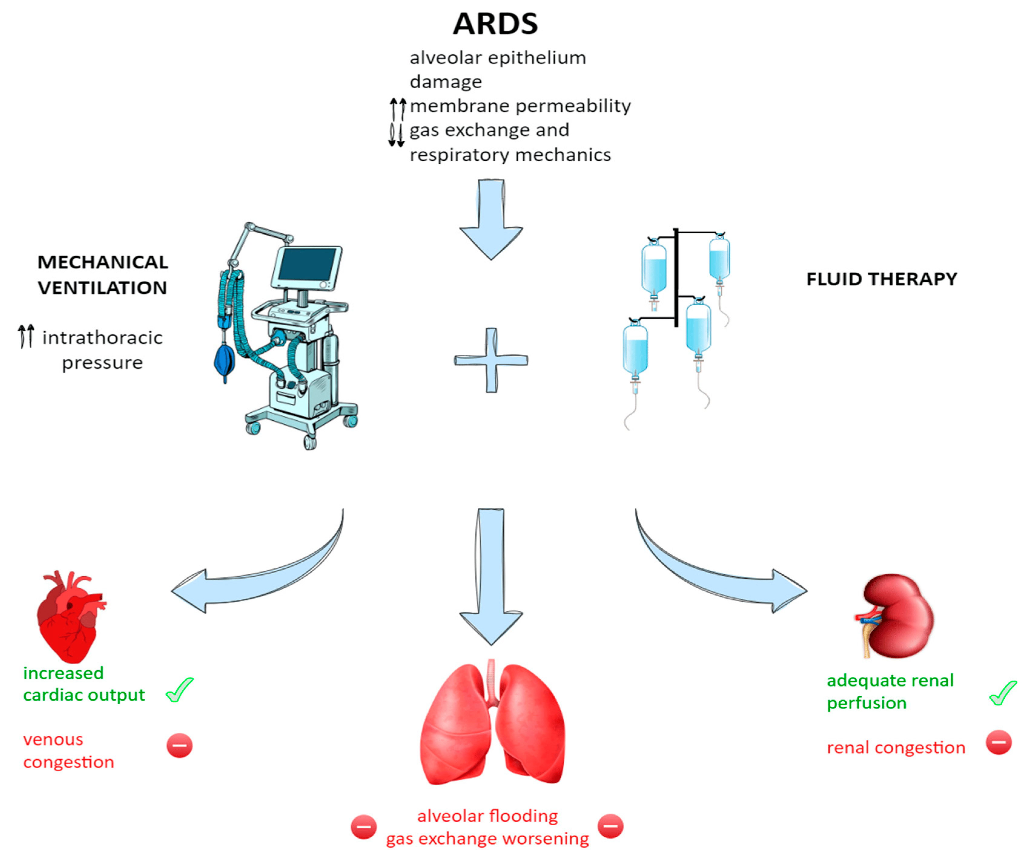 Acute Respiratory Distress Syndrome and Fluid Management: Finding the ...